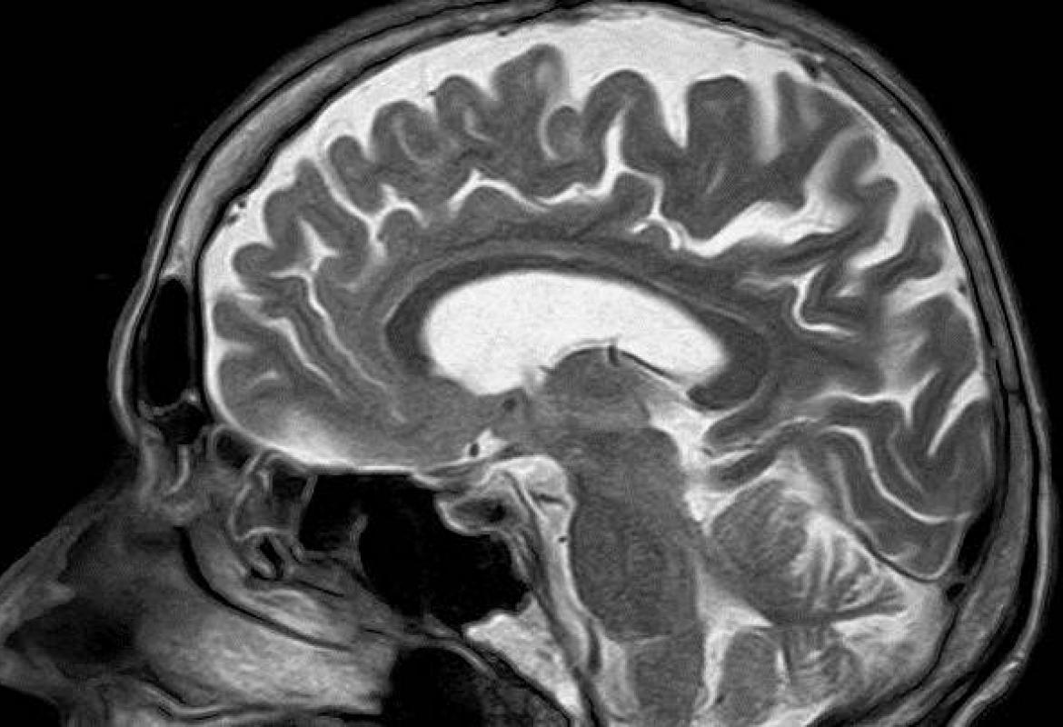 Mozak "punoljetan" tek sa 30 godina