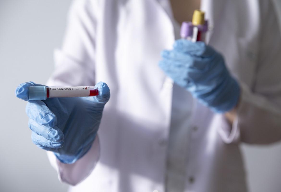 Naučite kako čitati nalaz krvi: Šta znače sve te kratice, kako se ...