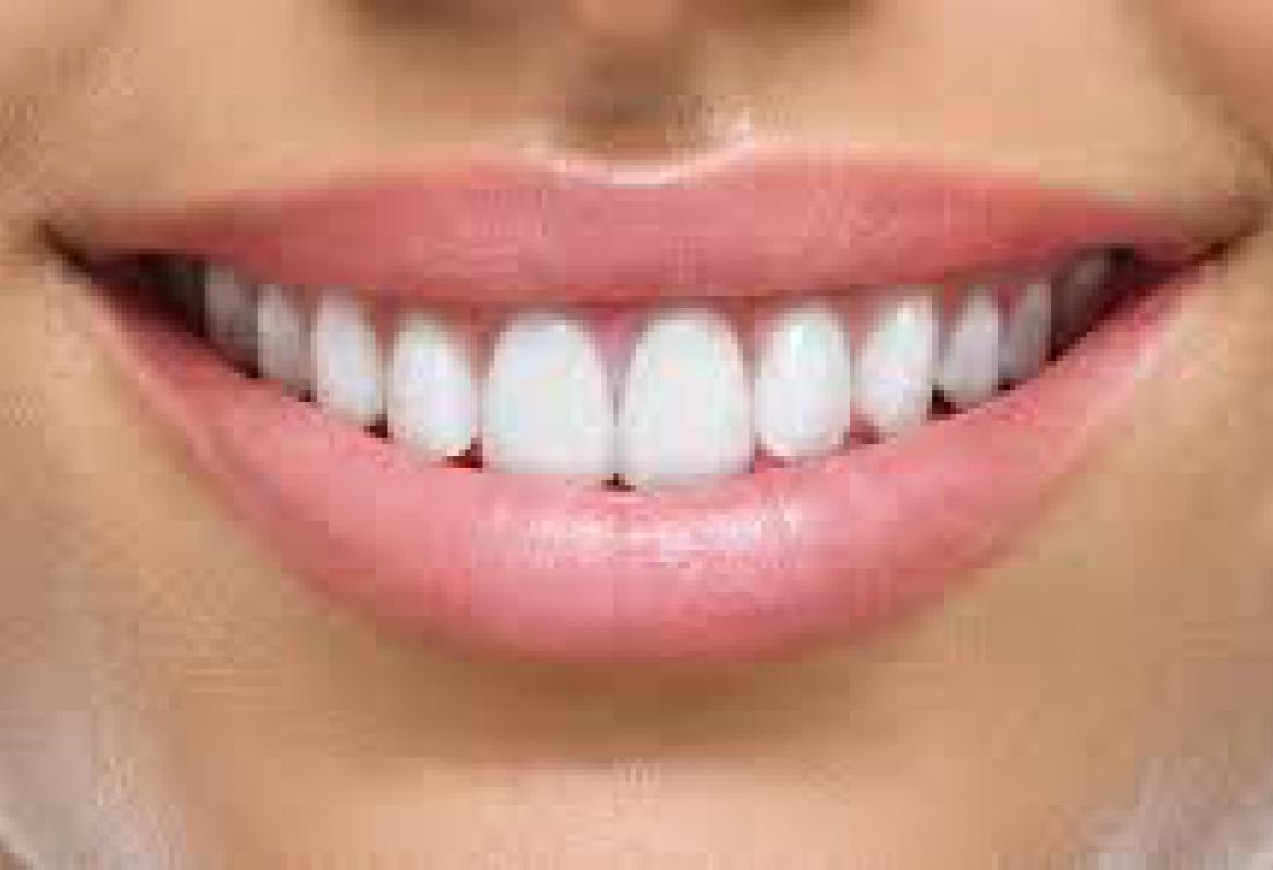 Ako vas muče žuti zubi, saznajte kako ih prirodno izbijeliti